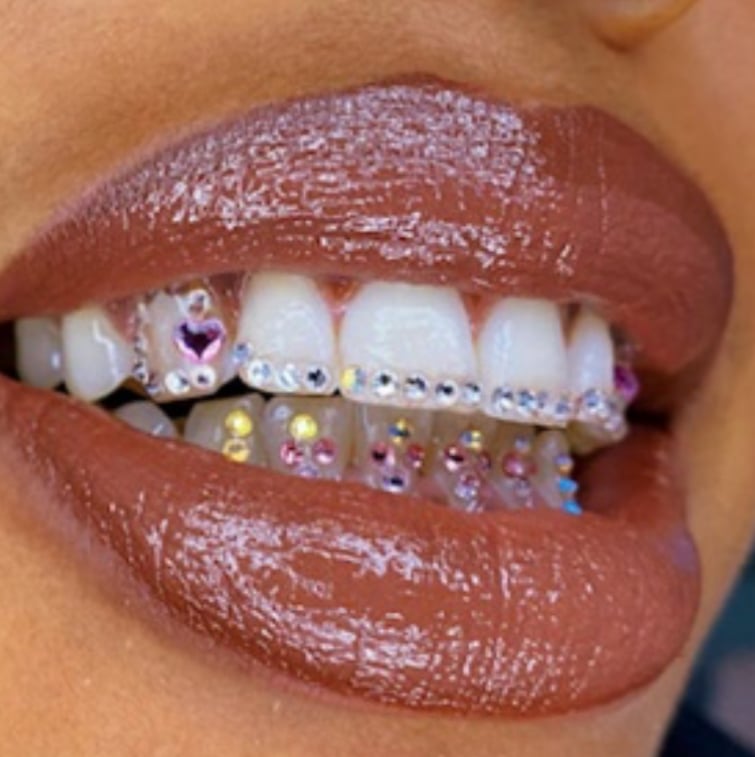 Tooth Gems in St. Louis | Enigma Tattoo & Piercing